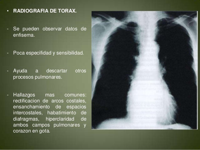 Enfermedad pulmonar obstructiva cronica (epoc)