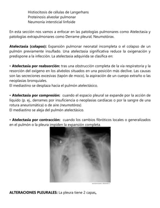 Enfermedad Pulmonar Restrictiva Tema 1.docx