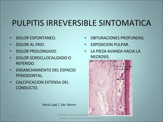 Enfermedad Pulpar A | PPT