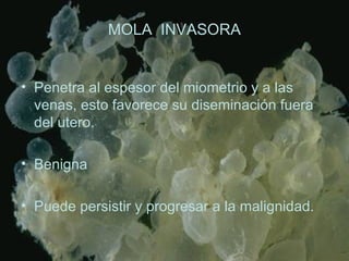 ENFERMEDAD TROFOBLASTICA GESTACIONAL | PPT