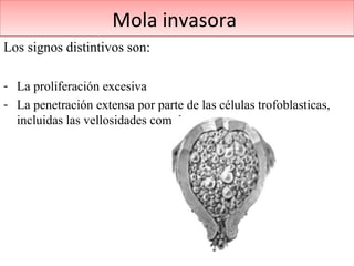 Enfermedad trofoblastica gestacional | PPT