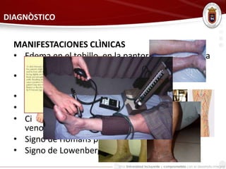 Enfermedad tromboembòlica venosa | PPTX