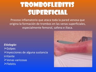 Enfermedad vascular periférica venosa aguda | PPT