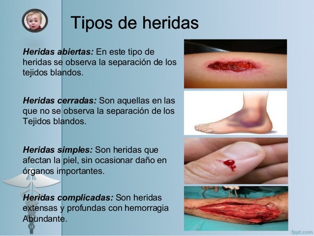 Proceso de Enfermeria