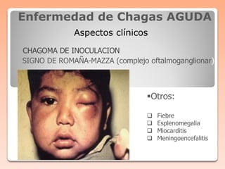 Enfermidad de chagas | PPT