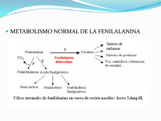 Fenilcetonuria | PPTX