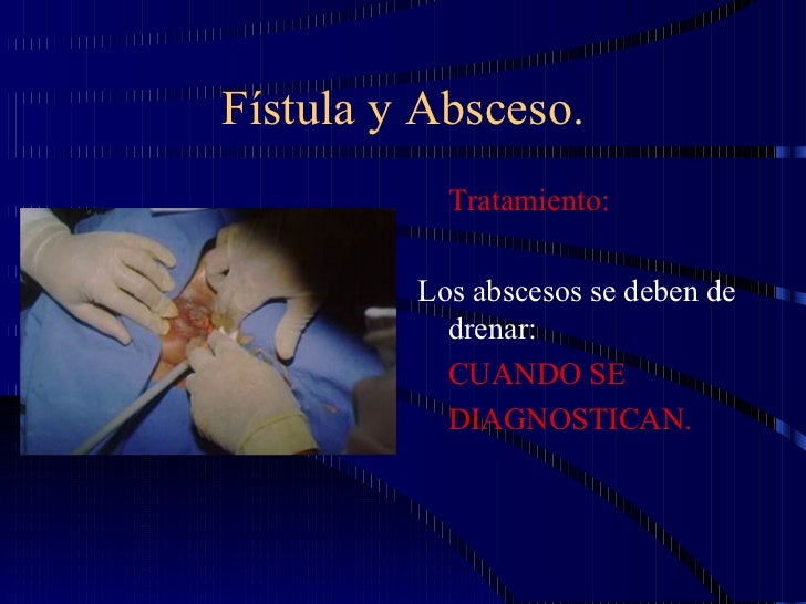 Enfermedad hemorroidal. Cirugía colo-rectal