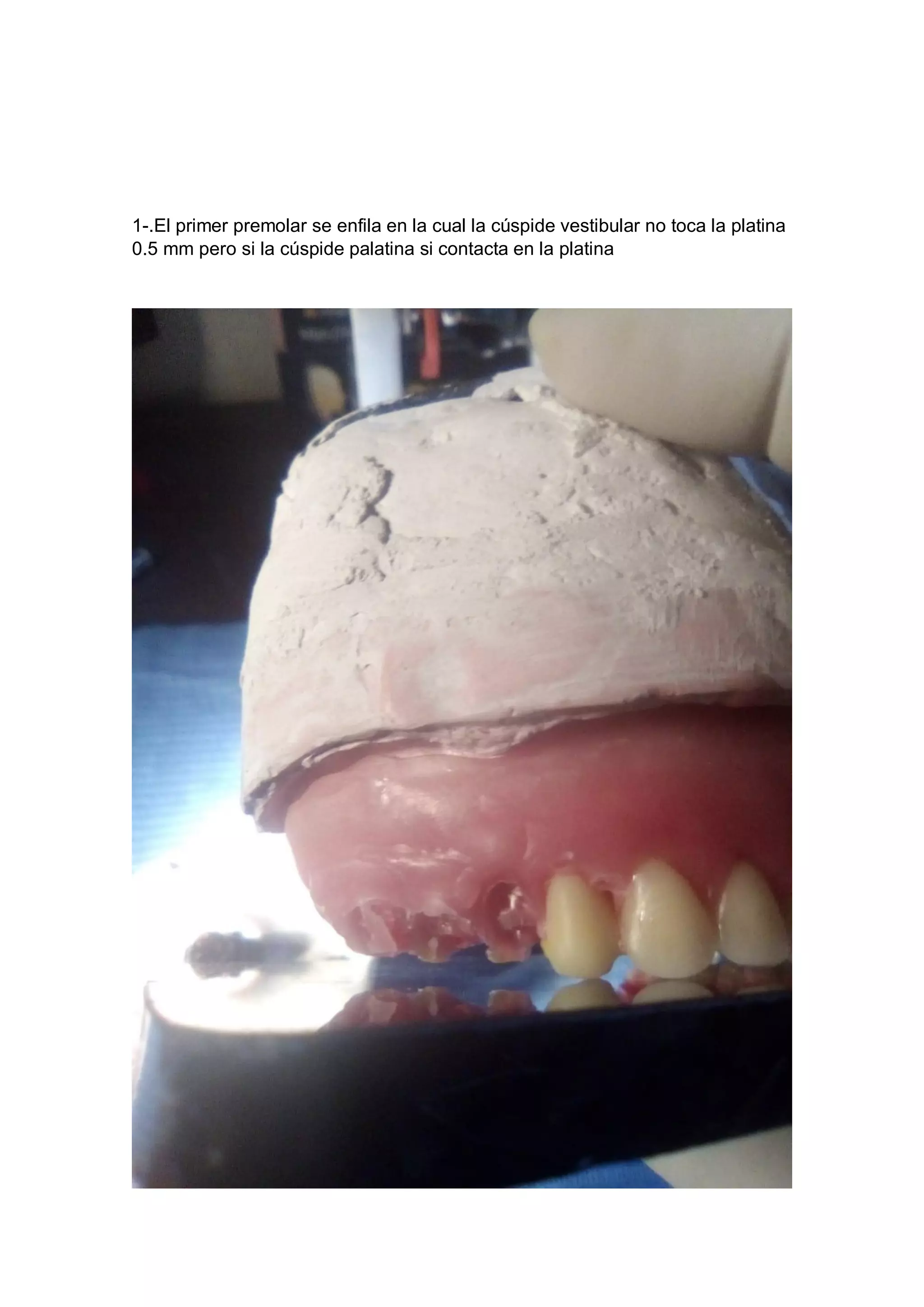 Enfilado de dientes sector postero superior.pdf