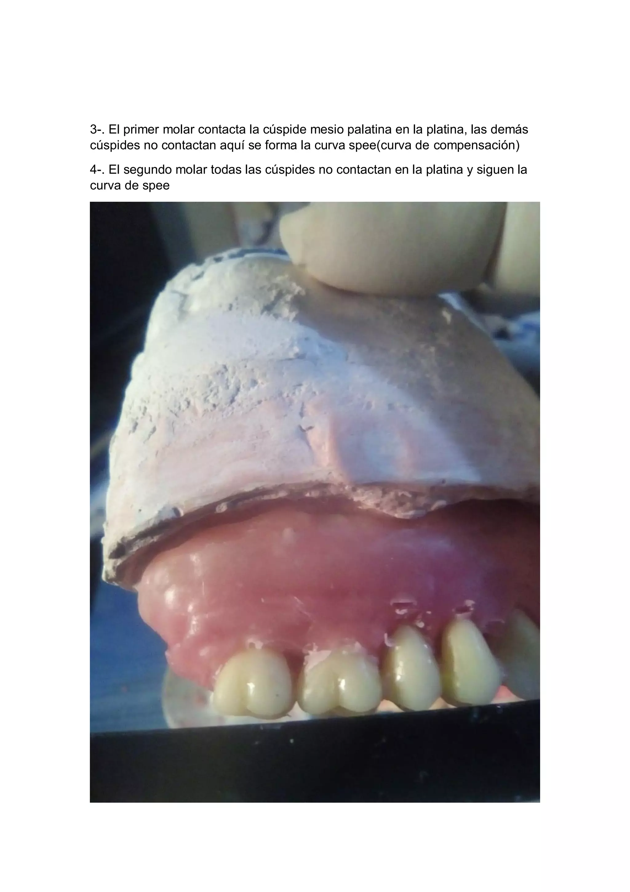 Enfilado de dientes sector postero superior.pdf