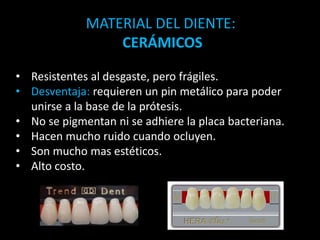 enfilado de dientes y caracterizacion.pptx