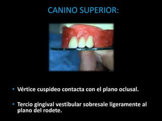 enfilado de dientes y caracterizacion.pptx