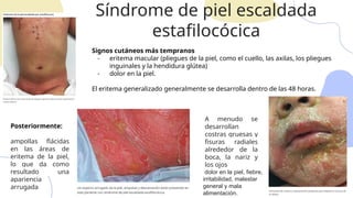 Enfermedades infecciosas de la piel, generalidades | PPTX