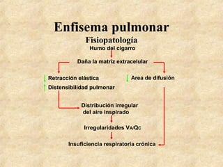 Lámina De Enfisema Pulmonar
