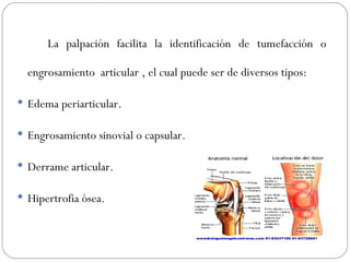 Enfoque del paciente con monoartritis | PPT