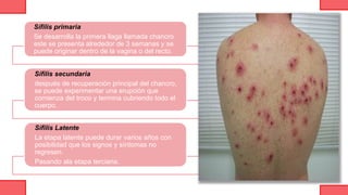 enfremedades_de_transmisicion_sexual....pptx