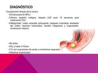 Enfermedad ulceropeptica | PPTX