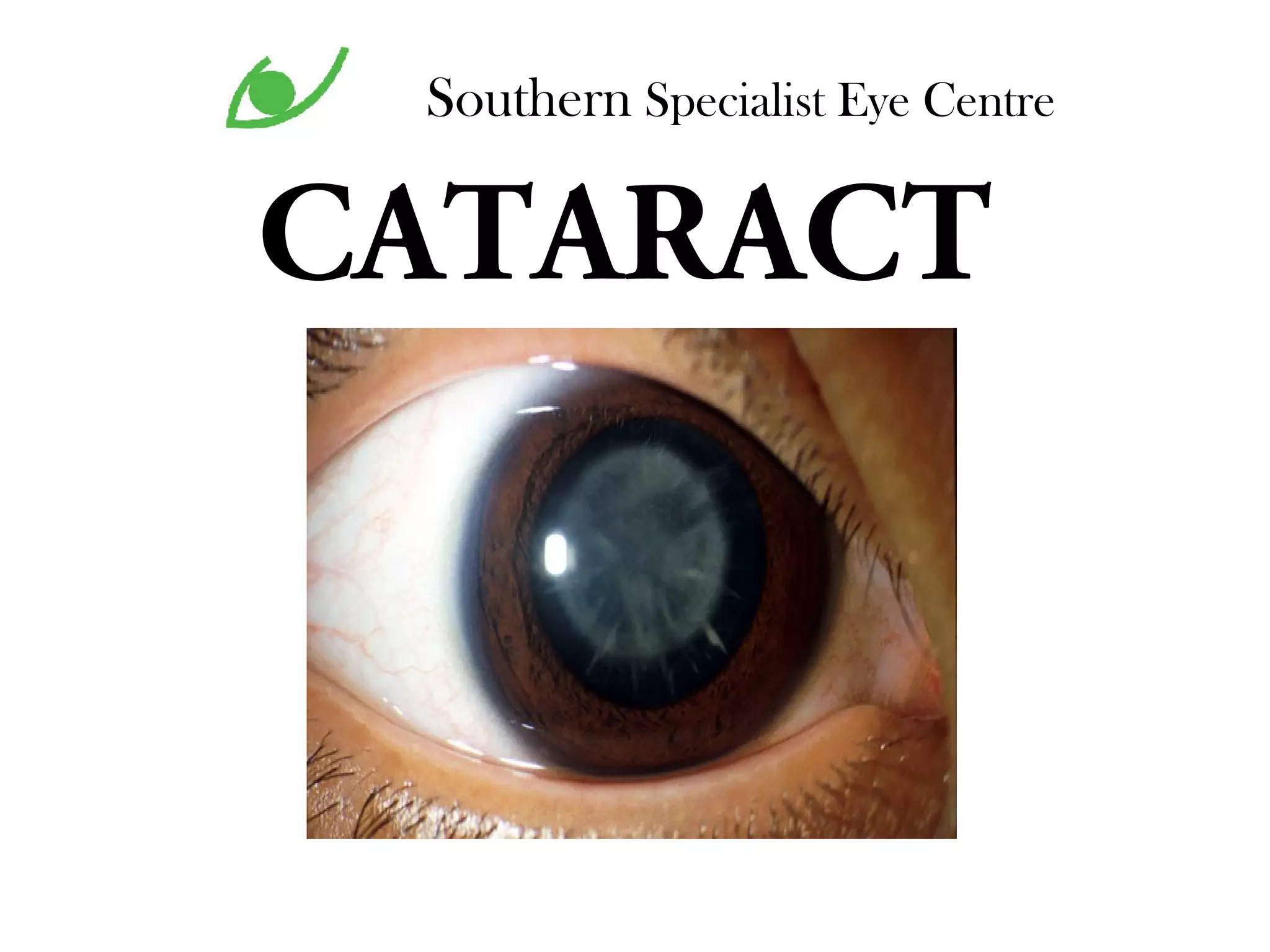 Eng cataract counselling ssec | PPT | Eye and Vision Conditions ...