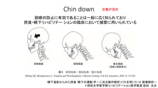 嚥下と誤嚥性肺炎について | PPTX