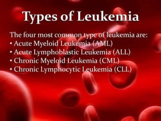 Leukemia Powepoit Presentation | PPTX