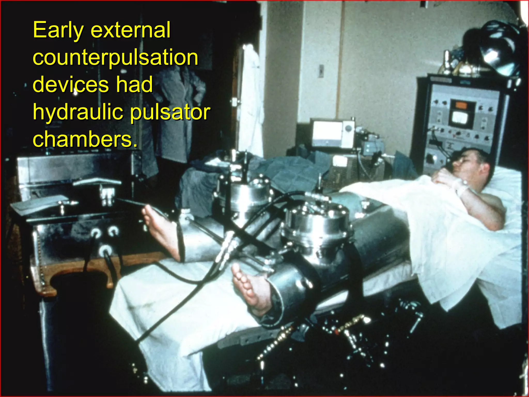 Enhanced external counterpulsation (eecp) role in | PPT