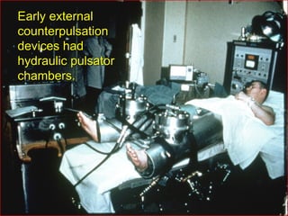 Enhanced external counterpulsation (eecp) role in | PPT