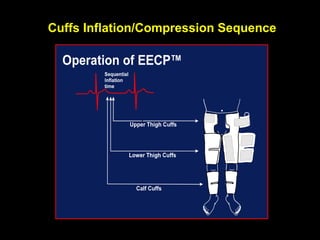 Enhanced external counterpulsation (eecp) role in | PPT