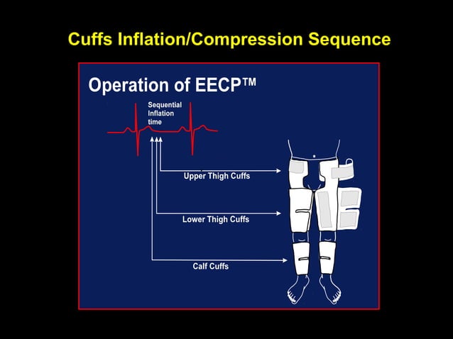 Enhanced external counterpulsation (eecp) role in | PPT | Heart and ...