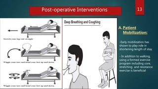 Enhanced Recovery After Colorectal Surgery | PPTX