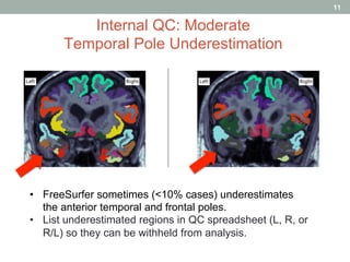 ENIGMA_Cortical_QC_2.0.pdf