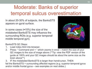 ENIGMA_Cortical_QC_2.0.pdf