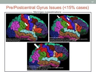 ENIGMA_Cortical_QC_2.0.pdf