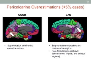 ENIGMA_Cortical_QC_2.0.pdf