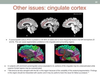 ENIGMA_Cortical_QC_2.0.pdf