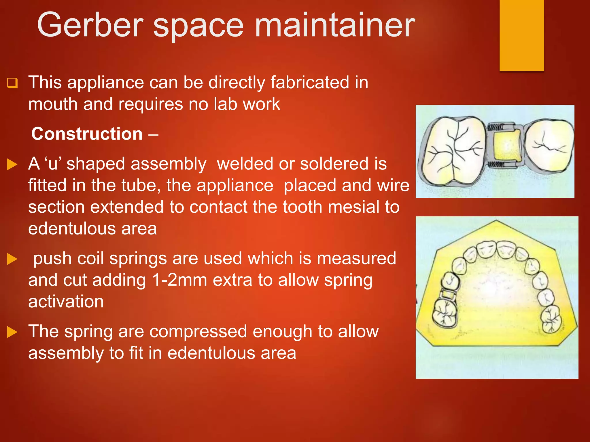 Space regaining procedure in pediatric dentistry | PPTX