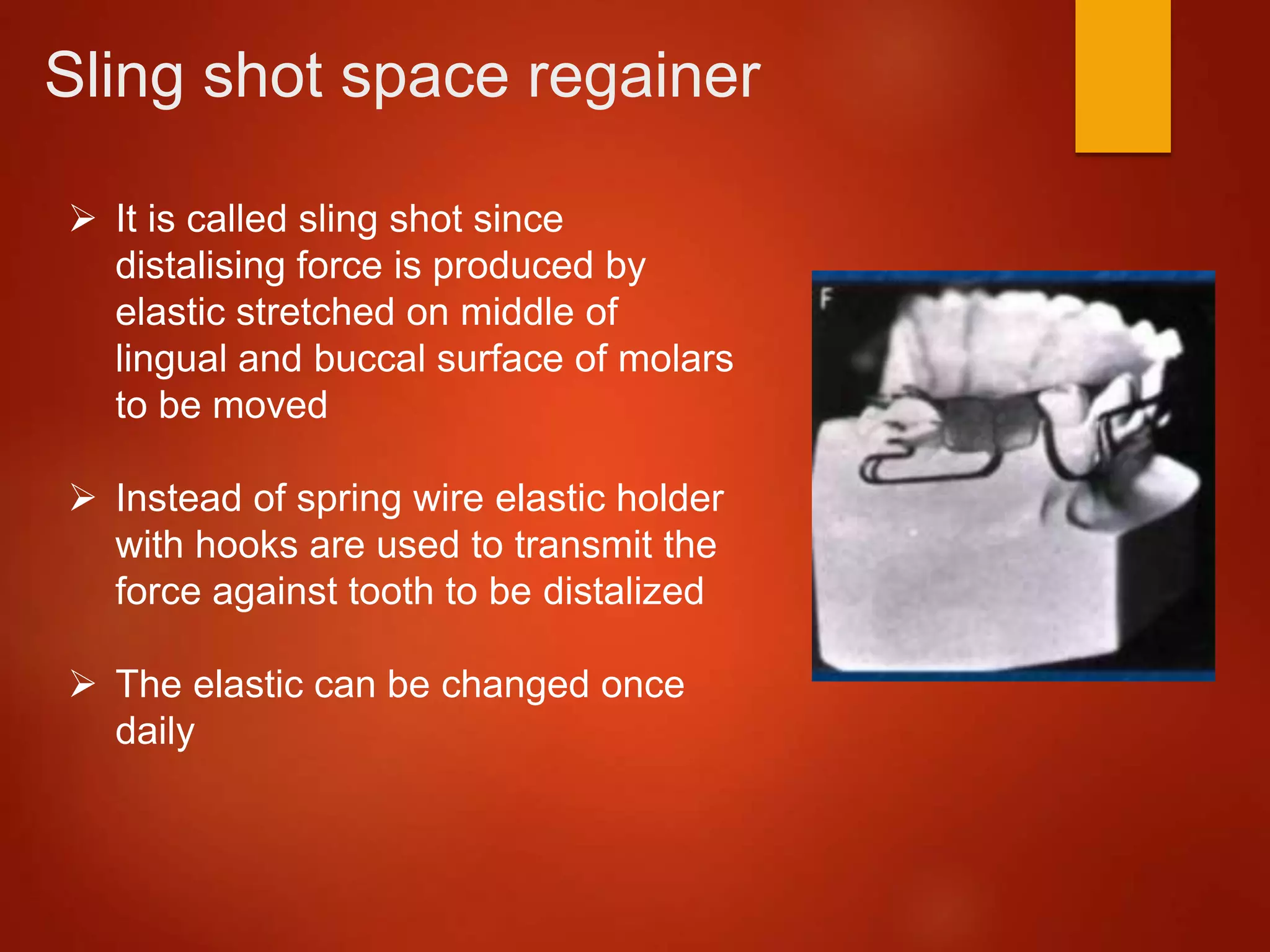 Space regaining procedure in pediatric dentistry | PPTX