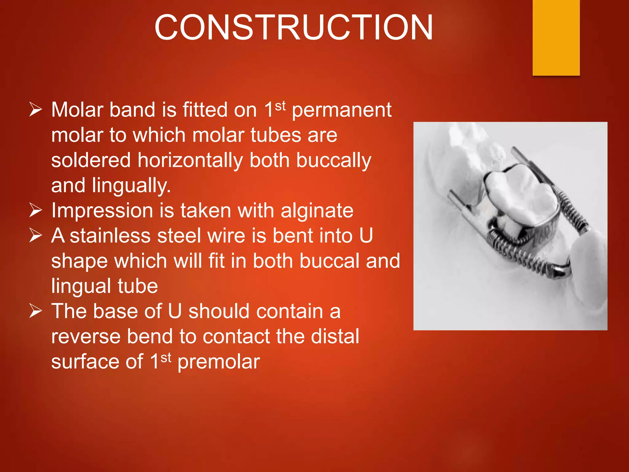 Space regaining procedure in pediatric dentistry | PPTX