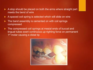 Space regaining procedure in pediatric dentistry | PPTX