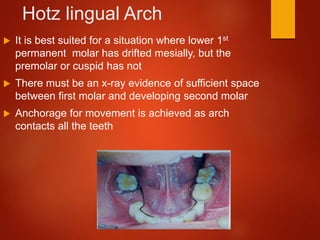 Space regaining procedure in pediatric dentistry | PPTX