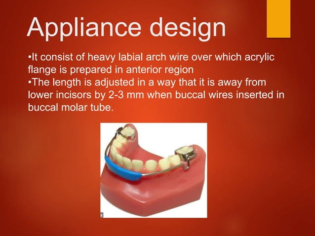 Space regaining procedure in pediatric dentistry | PPTX | Dental Health ...