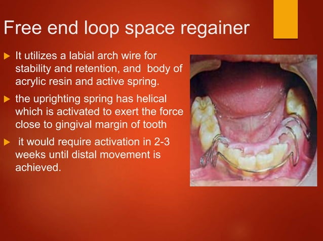 Space regaining procedure in pediatric dentistry | PPTX | Dental Health ...