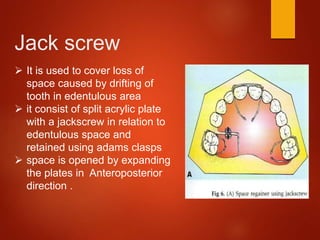 Space regaining procedure in pediatric dentistry | PPTX