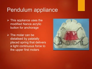 Space regaining procedure in pediatric dentistry | PPTX