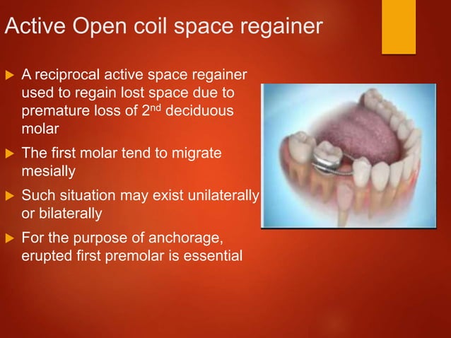 Space regaining procedure in pediatric dentistry | PPTX | Dental Health ...