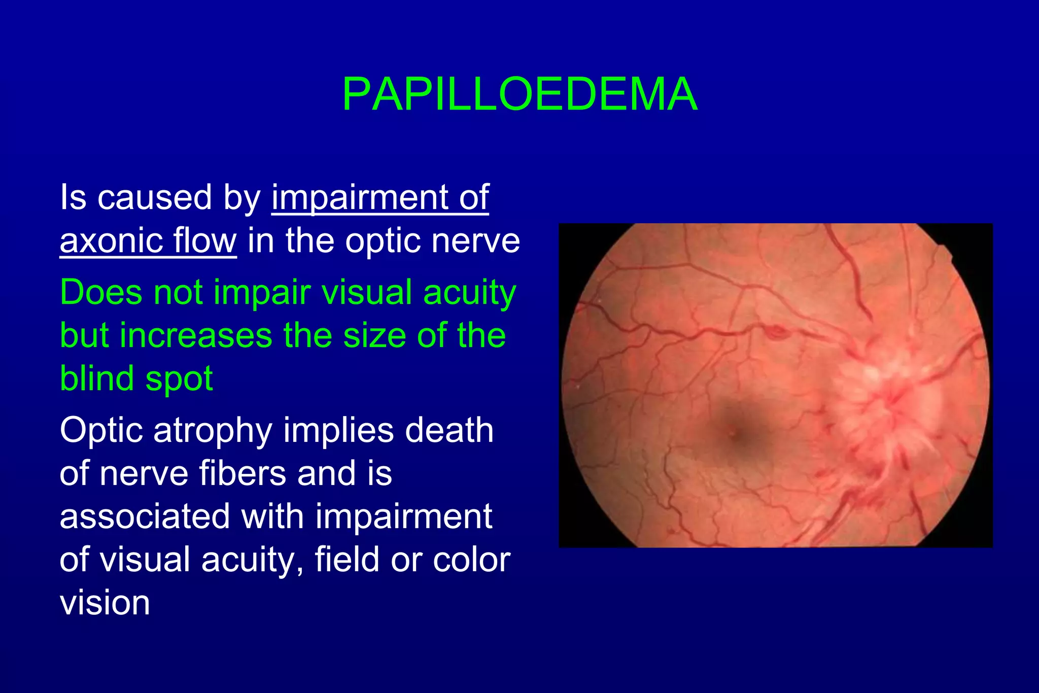 Ophthalmic Manifestations of Systemic Disorders | PPT