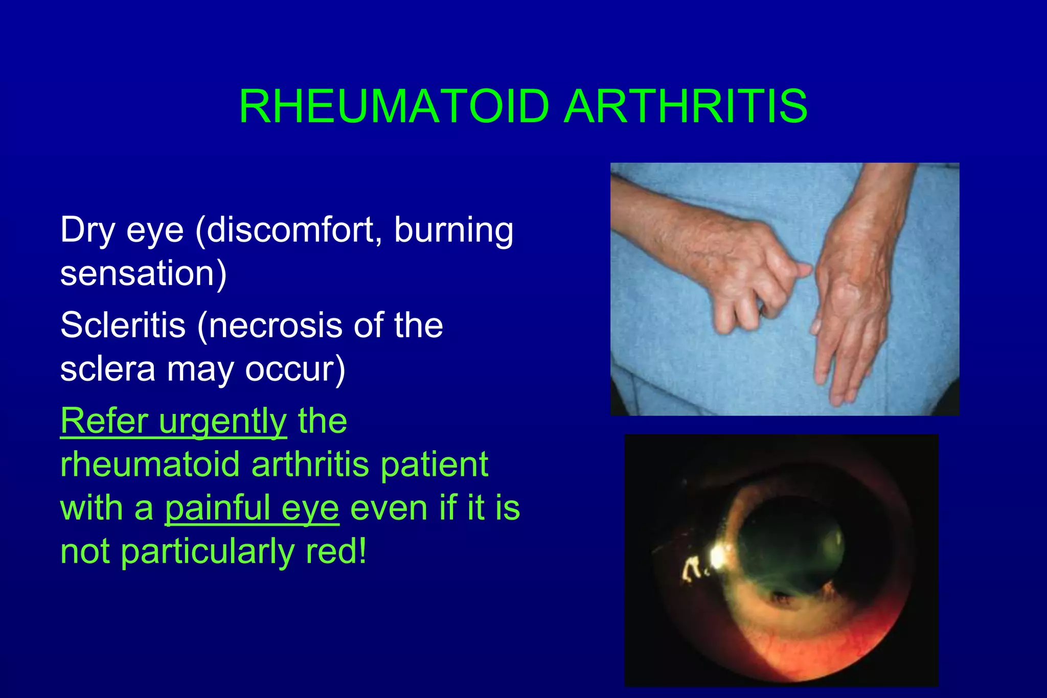 Ophthalmic Manifestations of Systemic Disorders | PPT