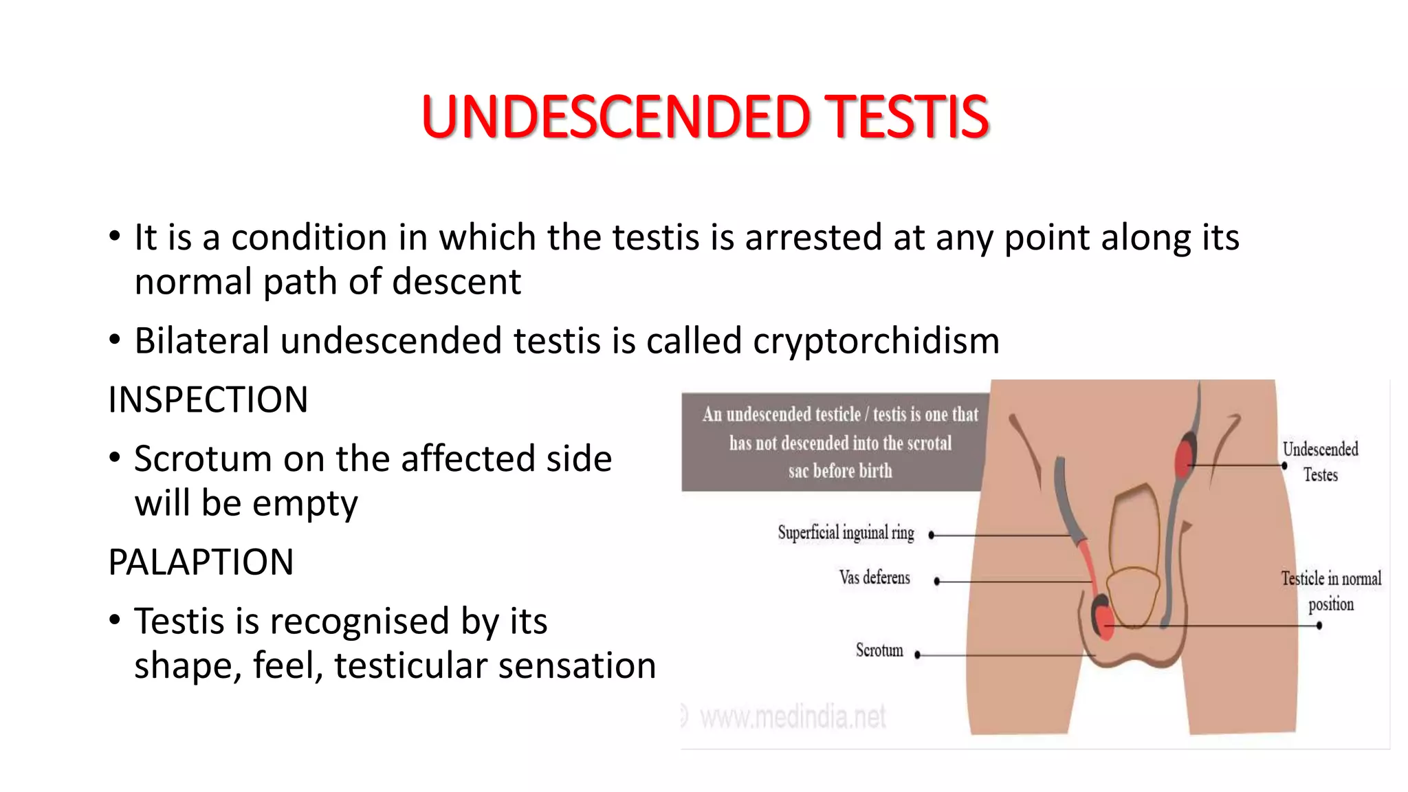 DIFFERENTIAL DIAGNOSIS OF INGUINOSCROTAL SWELLING | PPTX