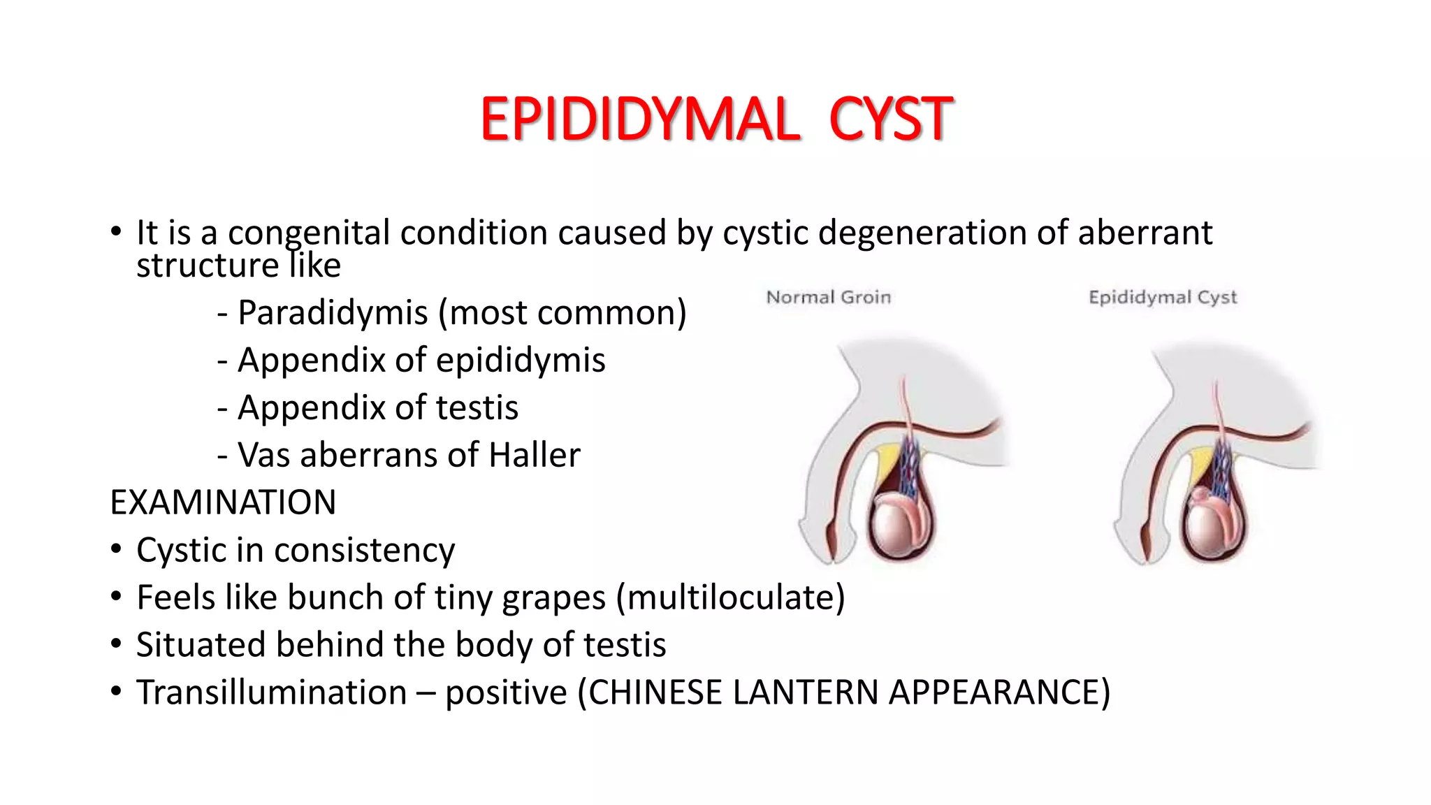 DIFFERENTIAL DIAGNOSIS OF INGUINOSCROTAL SWELLING | PPTX