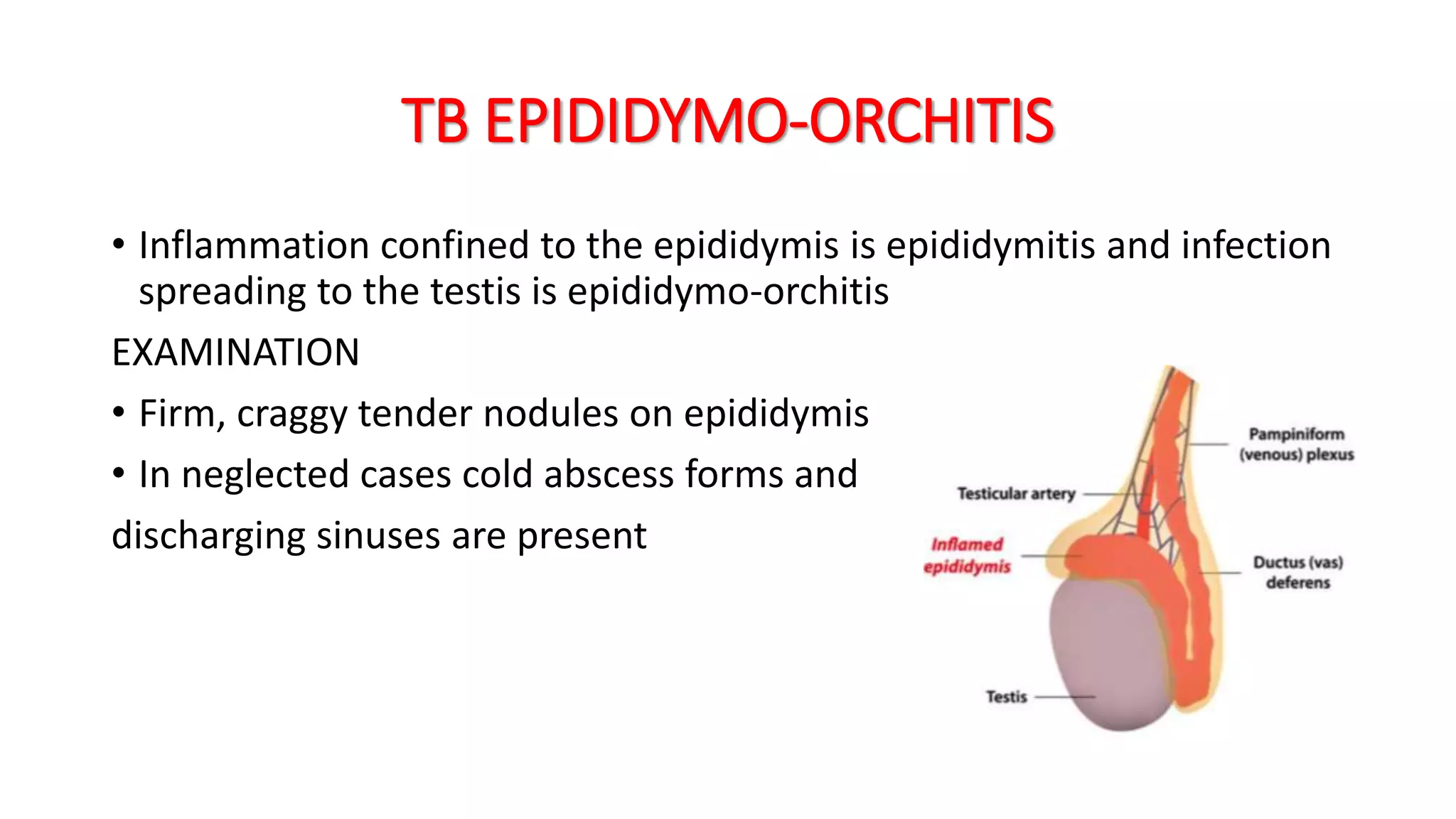 DIFFERENTIAL DIAGNOSIS OF INGUINOSCROTAL SWELLING | PPTX