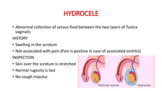 DIFFERENTIAL DIAGNOSIS OF INGUINOSCROTAL SWELLING | PPTX