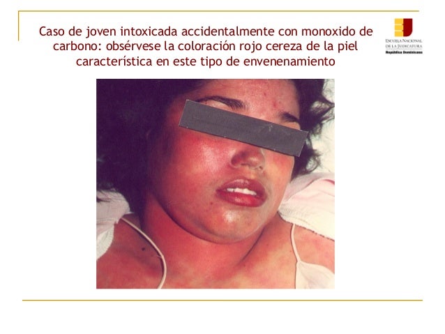 ENJ-300: Toxicología Forense